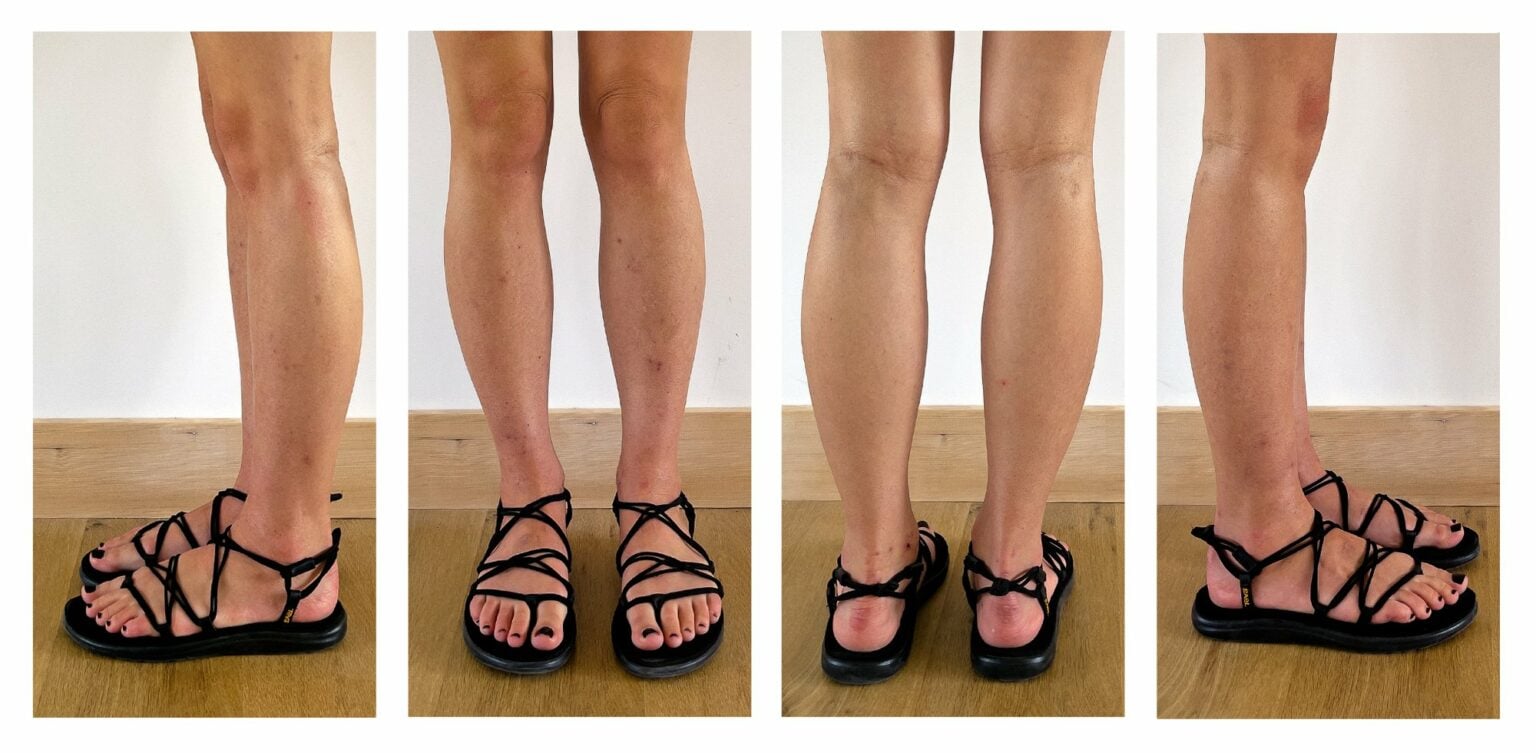 Ya, I got them 'cos Mary-Kate | Teva Infinity Sandals review